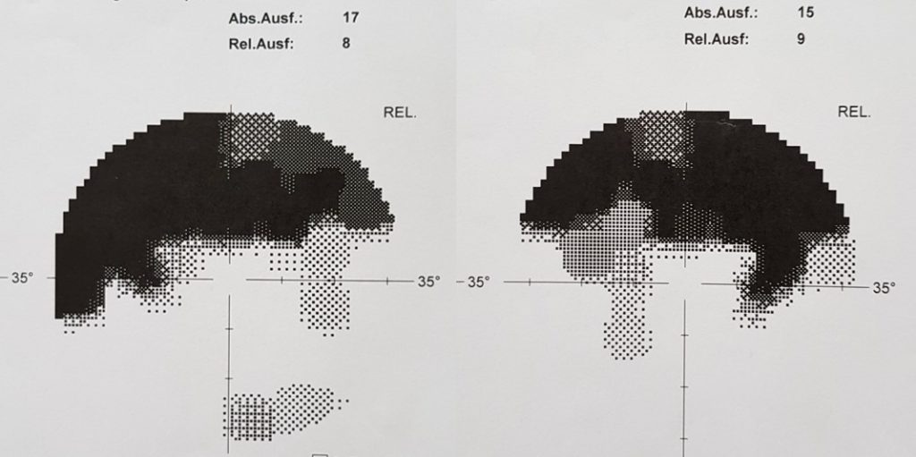 Elektro- und Sinnesphysiologie | Augenärzte am Dom | Makula Netzhaut ...